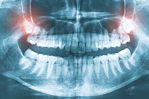 Toronto, North York & Kitchener Dental Specialists - Dental Specialty Group